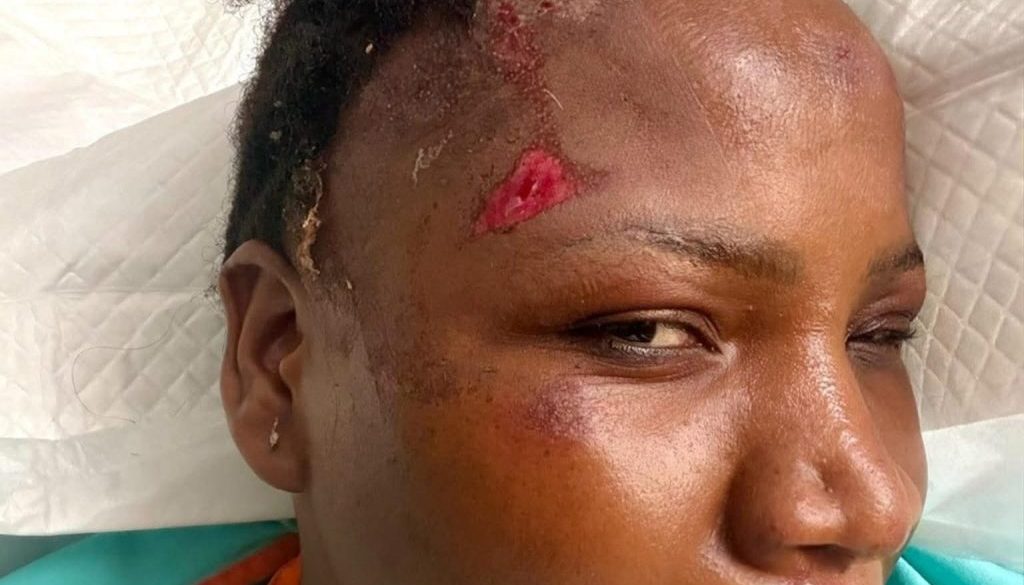 Makhadzi hurt by demands to prove accident - Limpopo Chronicle